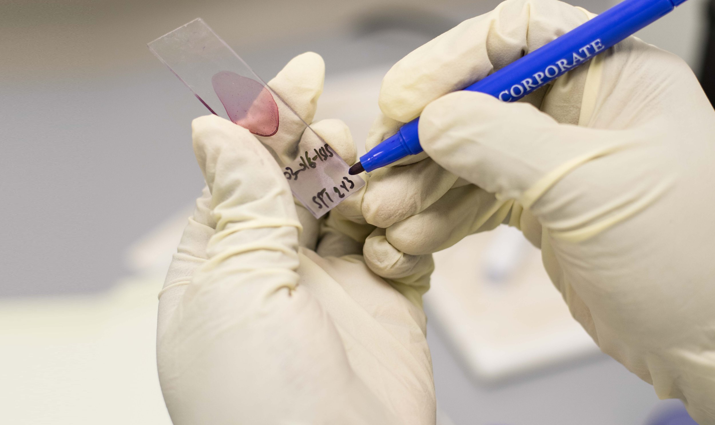 Over 4,000 African Health Workers to Undergo e-Learning on TB ...